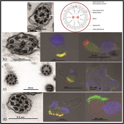 Examples Of Transmission Electron Microscopy Tem And Download Scientific Diagram
