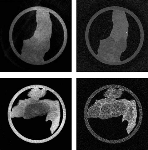 A And C Show One Tomographic Slice Of Each Specimen From Dpc Cbct