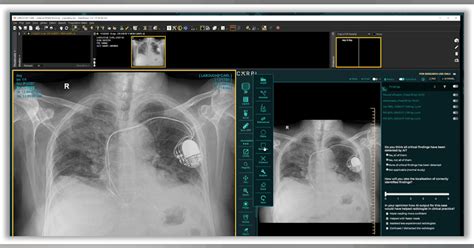 Startup Develops Imaging Ai Marketplace Platform Hci Innovation Group