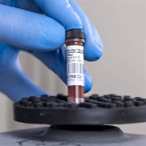 New Iqcp Template For Mdx Assays Streck