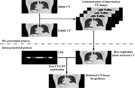 Figure 1 From A Fast Ct And Ct Fluoroscopy Registration Algorithm With