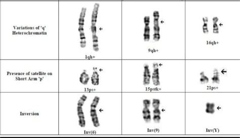 Tania Gonzalez Alvarez Posted On Linkedin