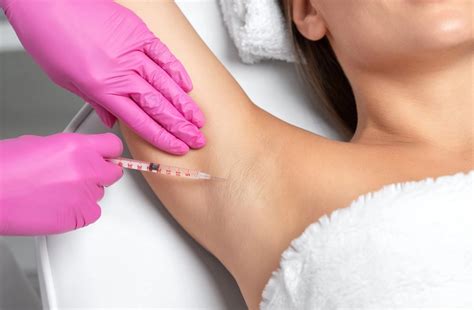 Botox For Hyperhidrosis Well Aesthetics Wellness