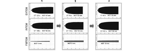 Rotem Rotational Thrombelastometry Tests 1 Left Panel One Day Download Scientific Diagram