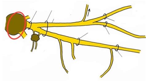 Maxillary Nerve Flashcards Quizlet