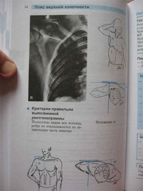 Книга: Атлас рентгенологических укладок - Меллер, Райф. Купить книгу ...