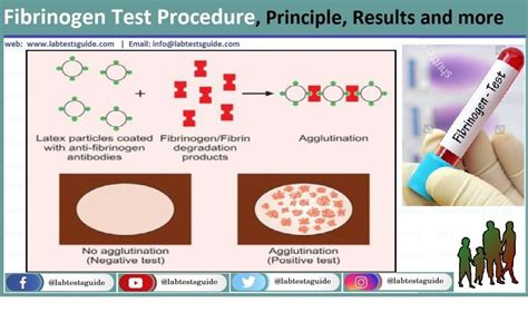 Fibrinogen Test Procedure Lab Tests Guide