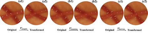 Figure 2 From Edge Guided Contrastive Adaptation Network For Arteriovenous Nicking