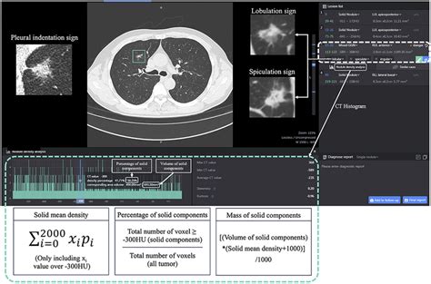 the ct histogram parameters using inferread ct lung an ai based