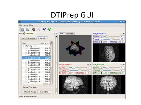 Ppt Diffusion Weighted Imaging Tensor Analysis Powerpoint Presentation Id1873936