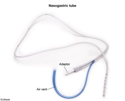 M7 Gastric Decompression NG Tubes Flashcards Quizlet