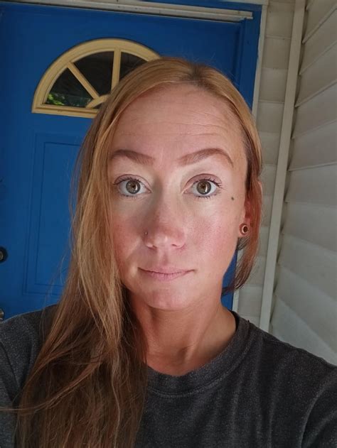 Been Out Of The Game In My 40s And Finding My Way Rosacea And