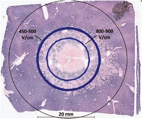 Figure 5 From Histological And Finite Element Analysis Of Cell Death