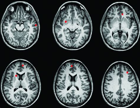 Sex Differences In Resting State Functional Connectivity In Multiple