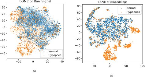 Figure 6 From Self Supervised Representation Learning Based Osa Detection Method Using Single