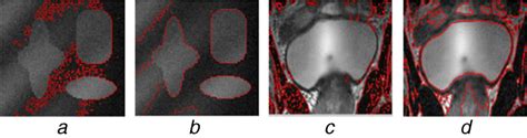 segmentation results of images with grey‐scale inhomogeneity a raw