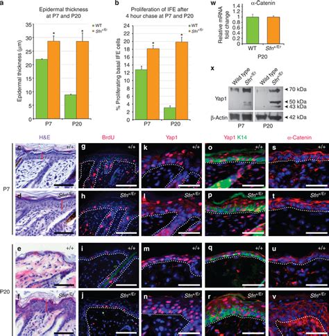 Sfner Interfollicular Epidermis Ife Is Hyperproliferative A