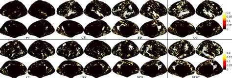 Figure 3 From How Does The Brain Process Syntactic Structure While Listening Semantic Scholar