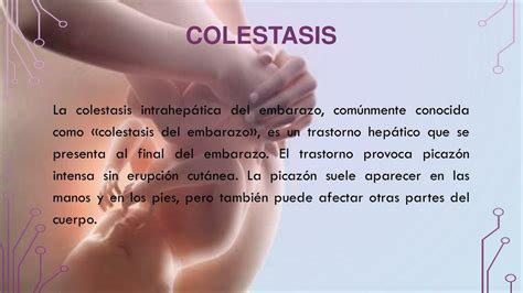 Colestasis Yamile Anahi Agüero Udocz
