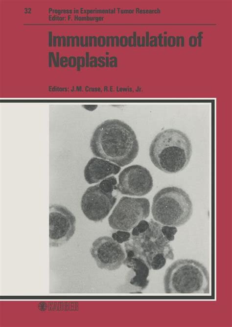 Immunomodulation Of Neoplasia By Interleukin 21 Immunomodulation Of