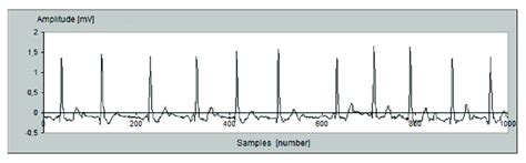 Graph Of Original Ecg Signal Download Scientific Diagram