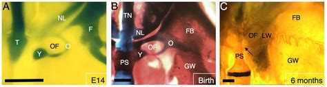Dorsal View Of Endocranium In Whole Mounts Showing Development Of