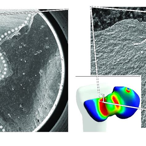 Sem Micrographs Of Fracture Patterns Relating To Calculated Stresses Download Scientific