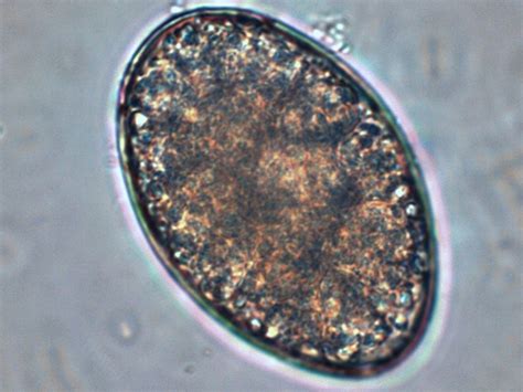 Lecture Notes In Medical Technology Lecture 5 The Cestodes Or Tapeworms