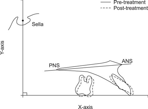The Coordinate System And Cephalometric Superimposition Of The Maxilla Download Scientific
