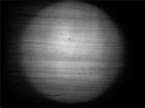 Micrographs Of Widefield Surface Plasmon Microscopy Of Human