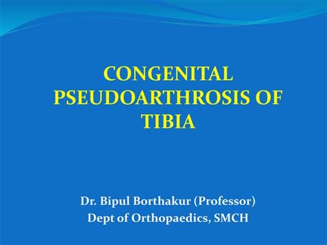 Congenital Pseudoarthrosis Of Tibia Pptx