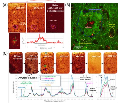 Label Free Spectroscopic Imaging Of Mouse Brain Slices With SRS A A