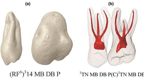 Micro Ct Models Showing Codes For Root Fusion Rf And