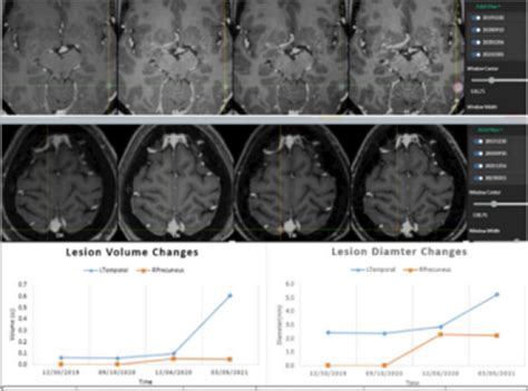 Research Gu Lab Stanford Medicine