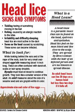 Head Lice Signs And Symptoms Kenosha News Infographic Flickr