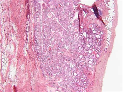 Frontiers The Role Of Adipose Tissue Dysfunction In The Pathogenesis