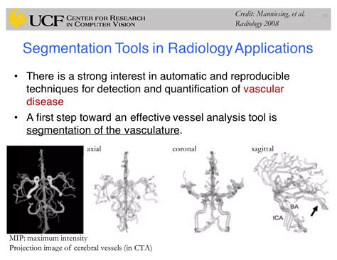Lec7 Medical Image Segmentation I Radiology Applications Of