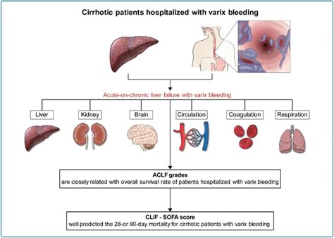 Best Aclf Specialist In Mumbai Best Aclf Specialist In South Mumbai