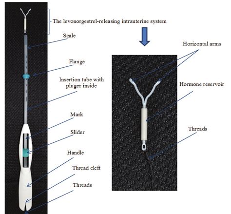 The Levonorgestrel Releasing Intrauterine System And Inserter Download Scientific Diagram