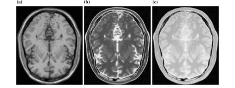 Simulated Brain Mri Image Slice 70 Obtained From Brainweb A