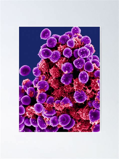 Staphylococcus Epidermidis Bacteria Sem Poster For Sale By Sciencesource Redbubble