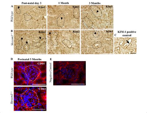 Shroom3 Gt Mice Do Not Exhibit Proximal Tubular And Glomerular