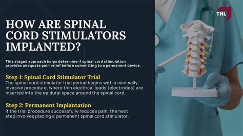 Spinal Cord Stimulator Lawsuit March 2026 Update