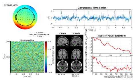 【补充:脑电绘图教程 2】如何手动去除ica伪迹分量ica独立成分分析去除伪迹 Csdn博客 【补充:脑电绘图教程 2】如何手动去除ica伪迹分量ica独立成分分析去除伪迹 Csdn博客