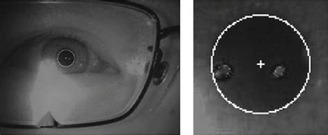 The Coarse And Precise Pupil Localization After Eliminating X G