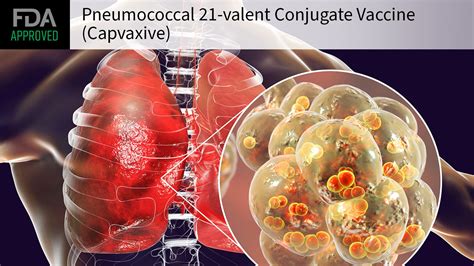 Fda Approves Pneumococcal Vax Designed Specifically For Adults