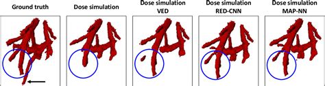 Figure 6 From Impact Of Image Denoising Techniques On Cnn Based Liver