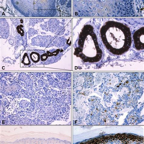 paraffin embedded tissue microarray samples were subjected to antigen