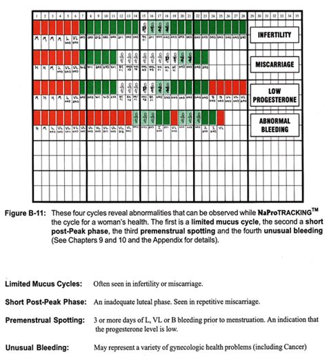 Naprotechnology He Remembers The Barren