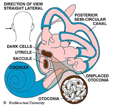 Crystals And Vertigo Ear